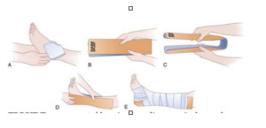 How to Splint Any Broken Bone | CU Wilderness Medicine
